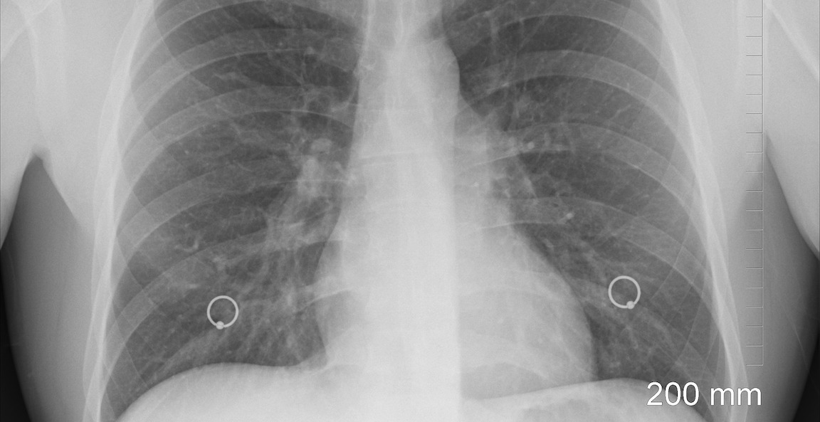 X-Ray scanning | Exeter Radiology